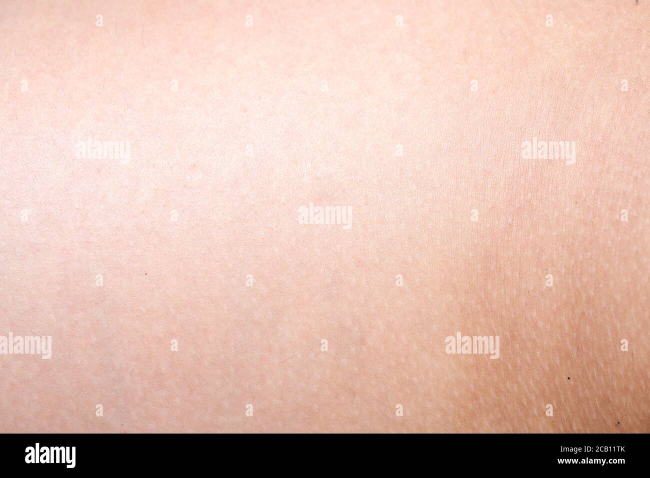 Healthy human skin as background Stock Photo - Alamy