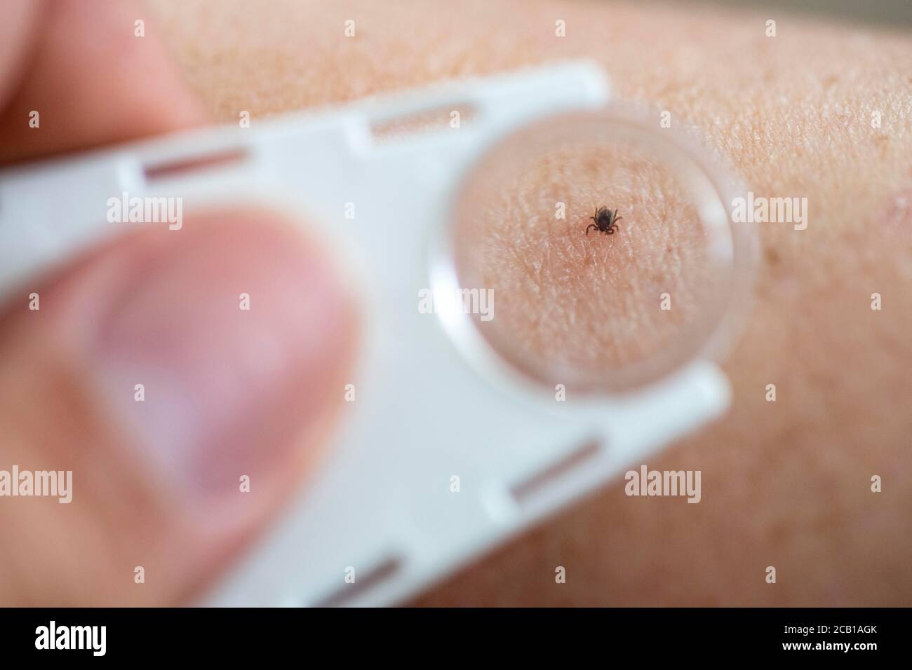 Castor Bean Tick (Ixodes ricinus), tick, view through magnifying glass ...