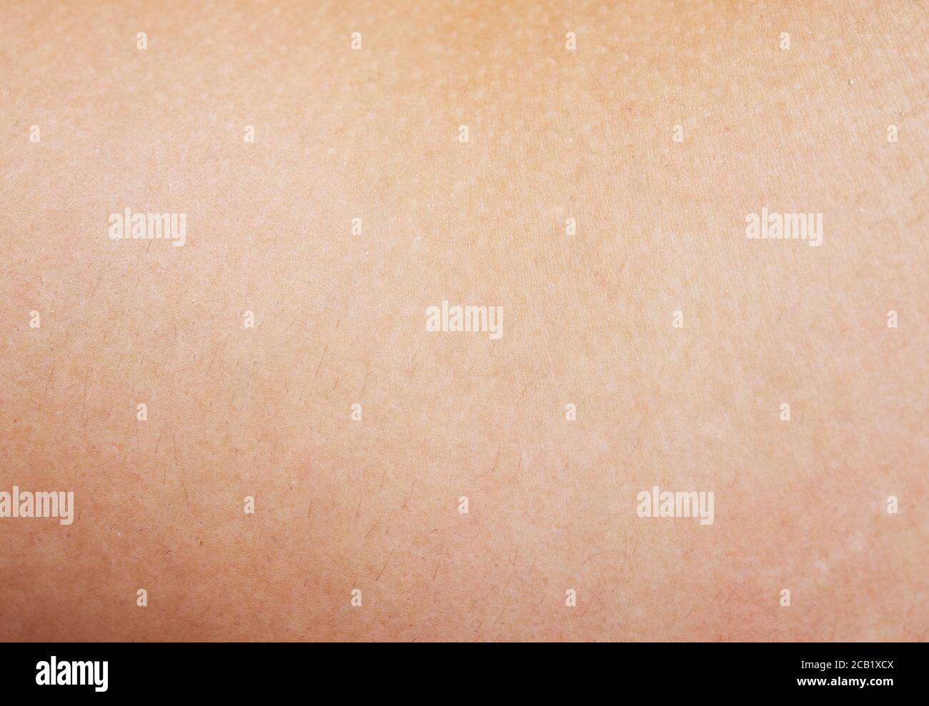 Healthy human skin as background Stock Photo - Alamy