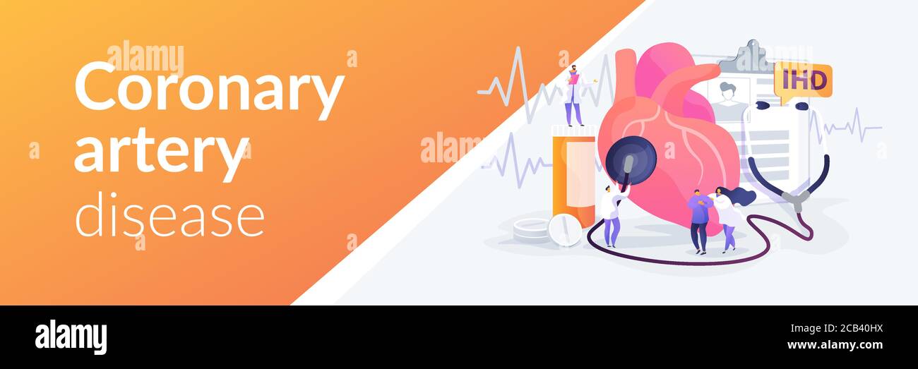 Ischemic heart disease concept banner header Stock Vector Image & Art ...