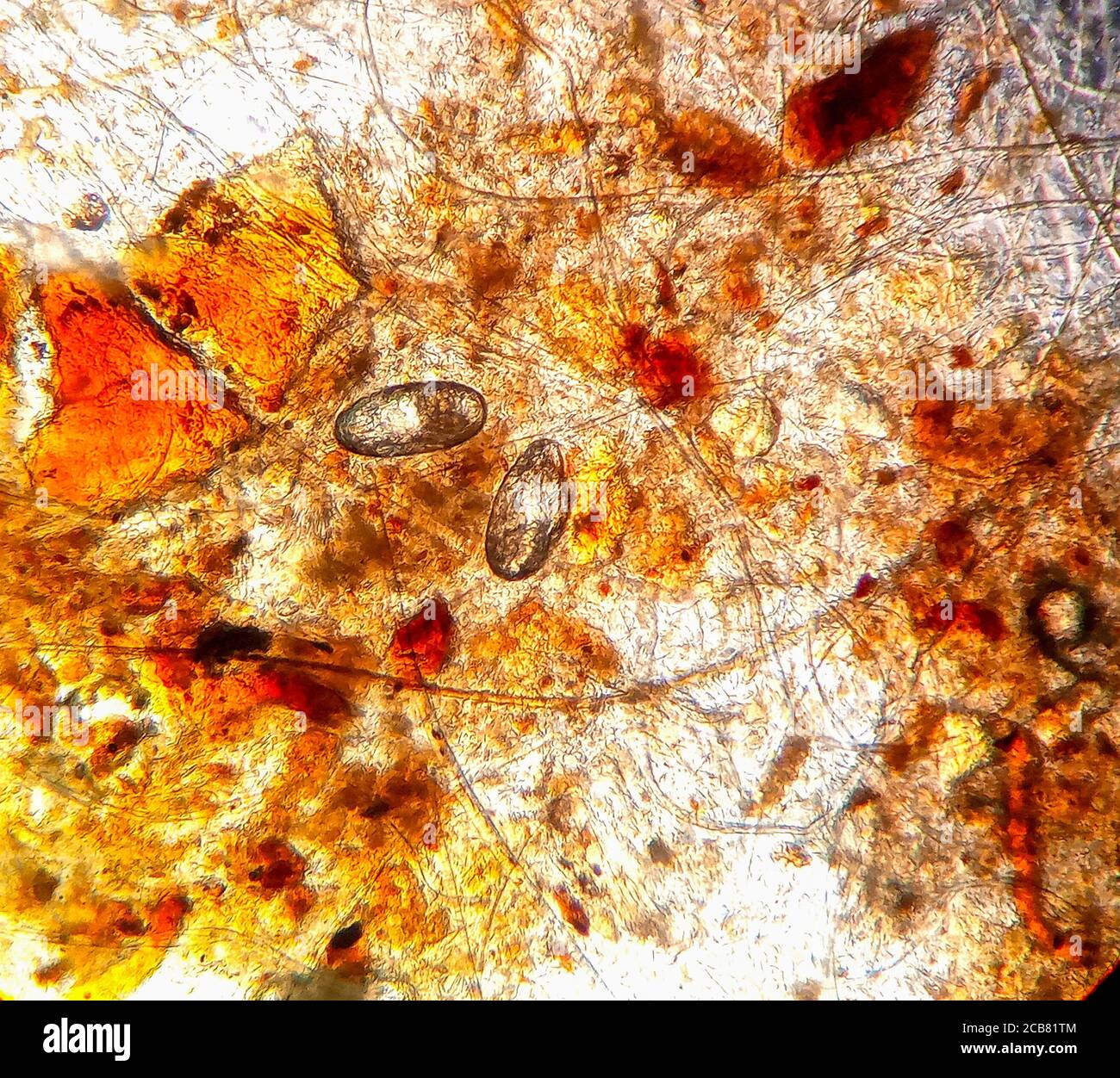 ear mite egg from a cat, under the microscope Stock Photo - Alamy