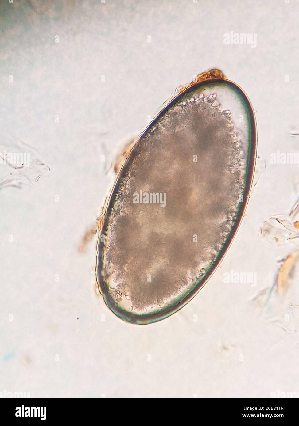 Parasites microscope hi-res stock photography and images - Alamy