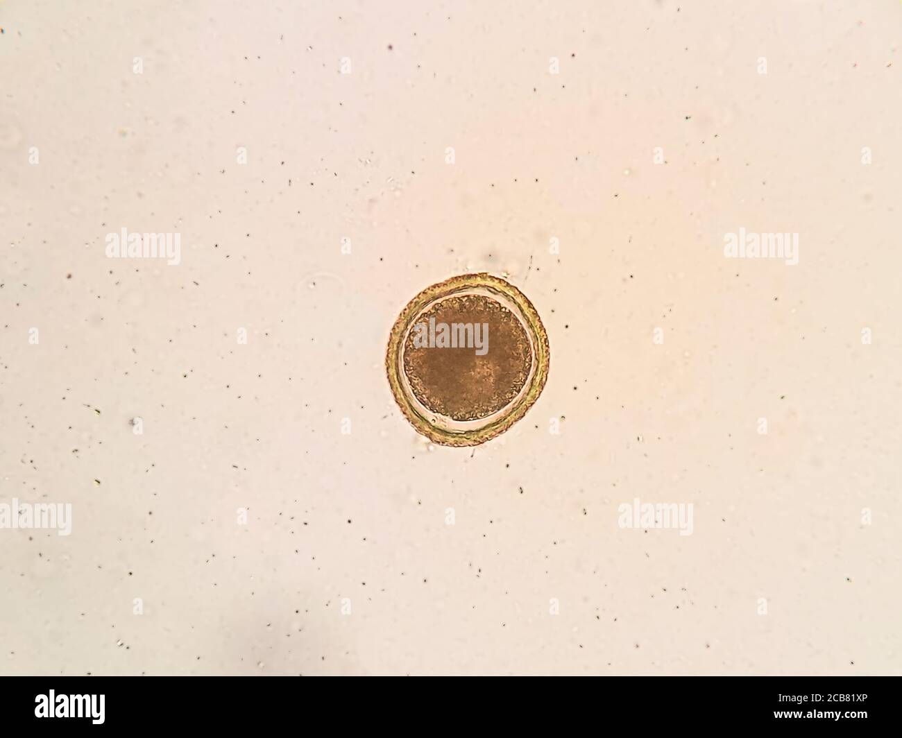 Toxocara roundworms hi-res stock photography and images - Alamy