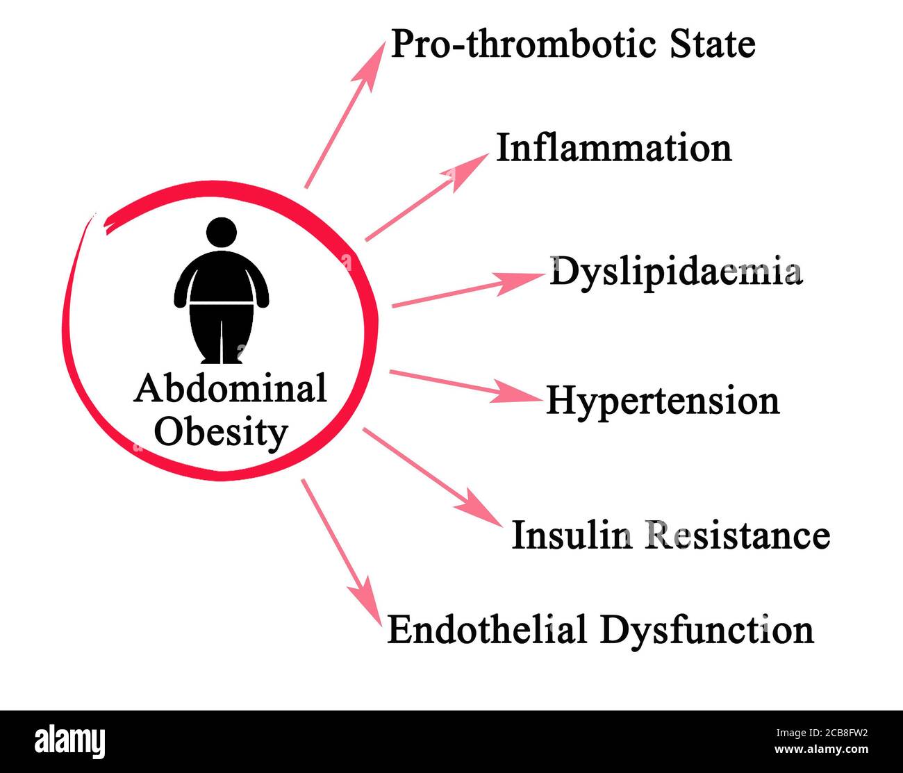 Abdominal obesity hi-res stock photography and images - Alamy