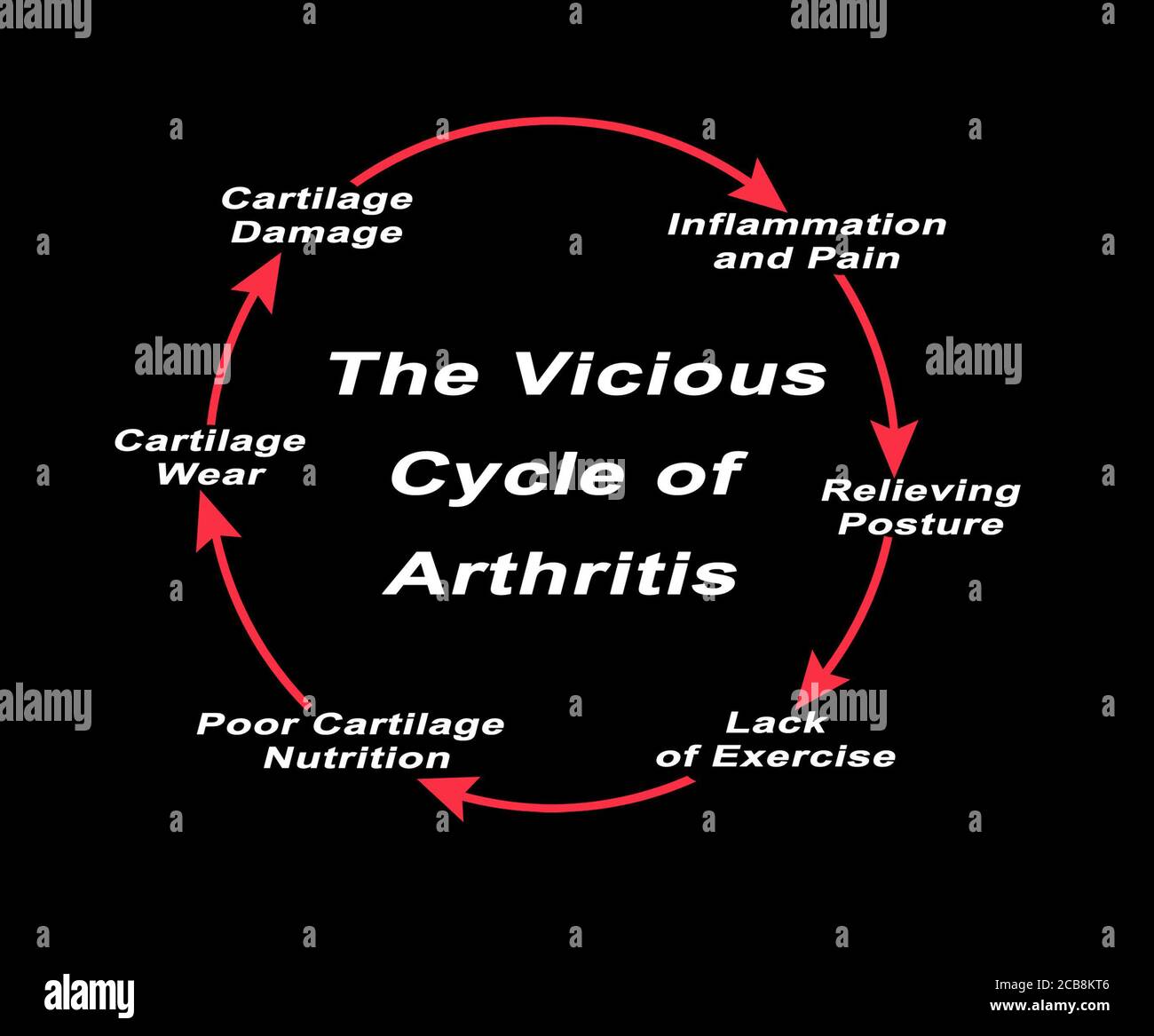 Steps in Vicious Cycle of Arthritis Stock Photo - Alamy