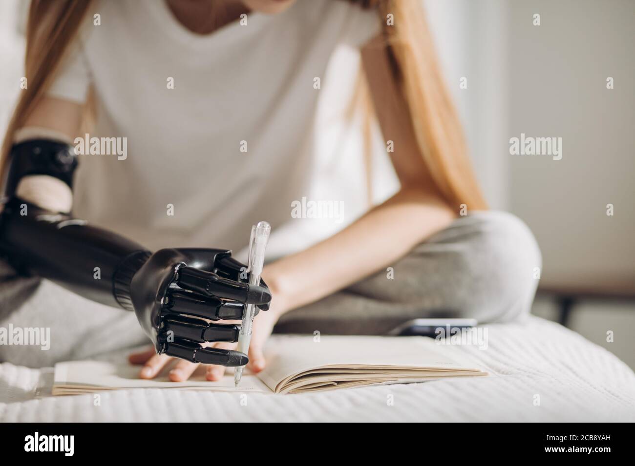 Woman one arm amputee hi-res stock photography and images - Alamy