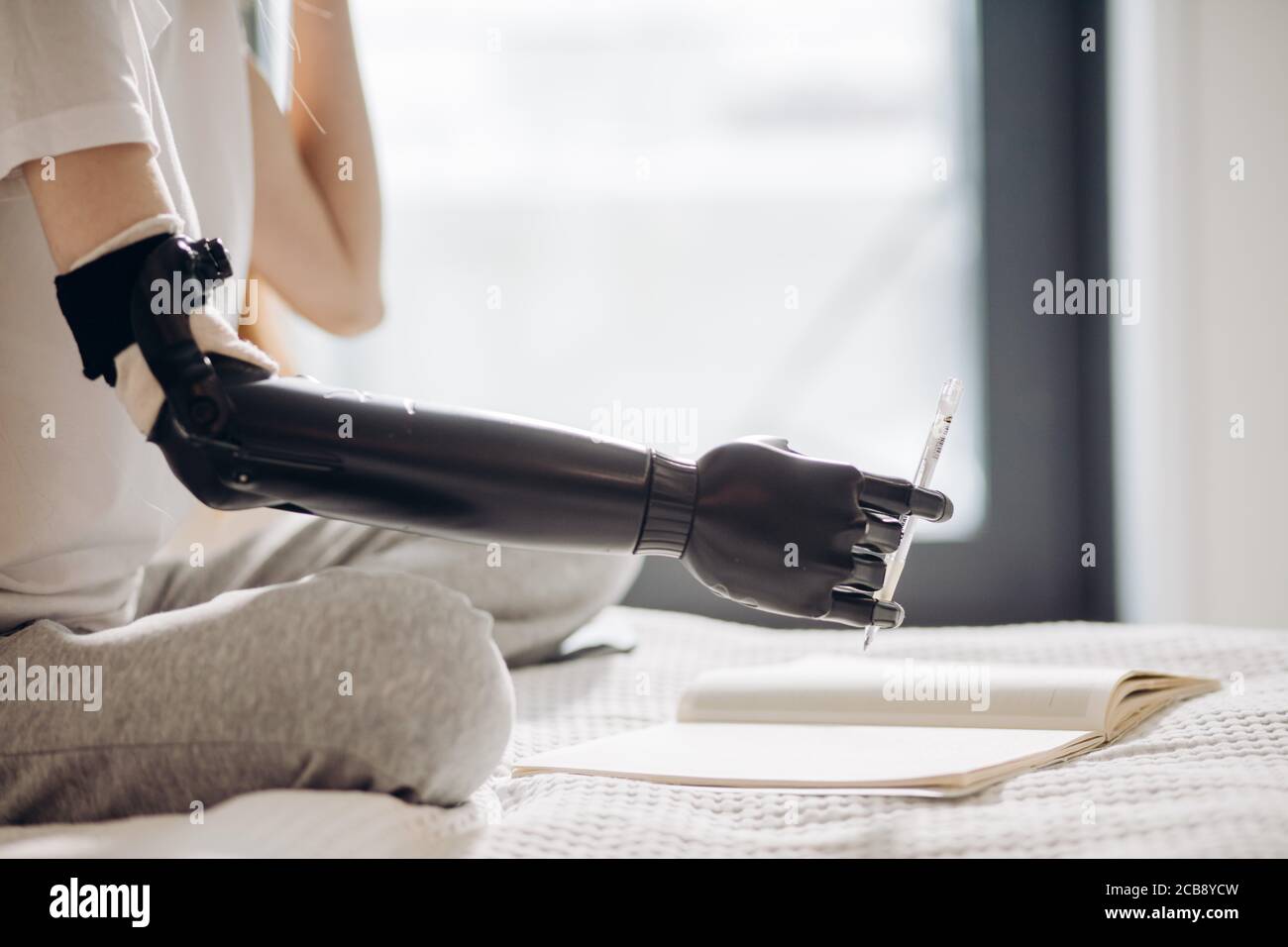 development in prosthetic arm systems, Prosthetic hand restores ...