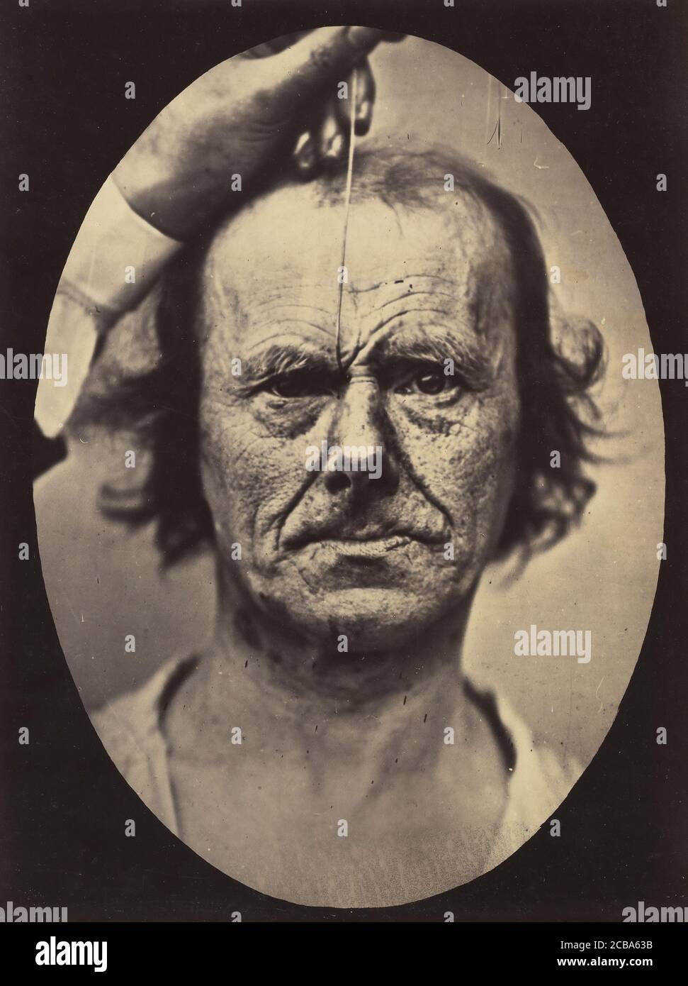 Muscles of facial expression (right) hi-res stock photography and ...