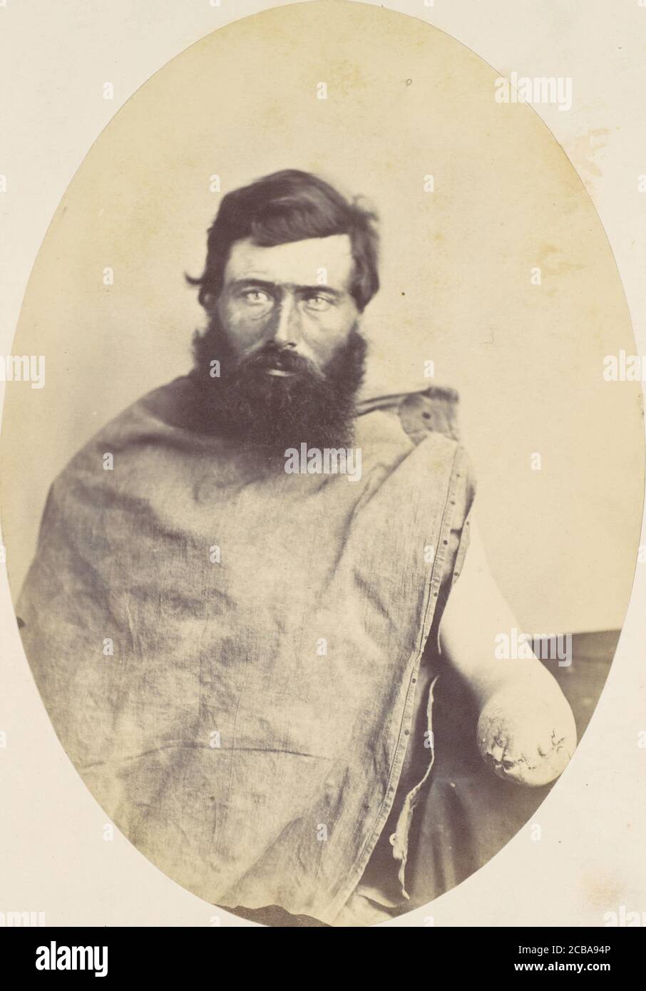 Civil war medicine museum hi-res stock photography and images - Alamy