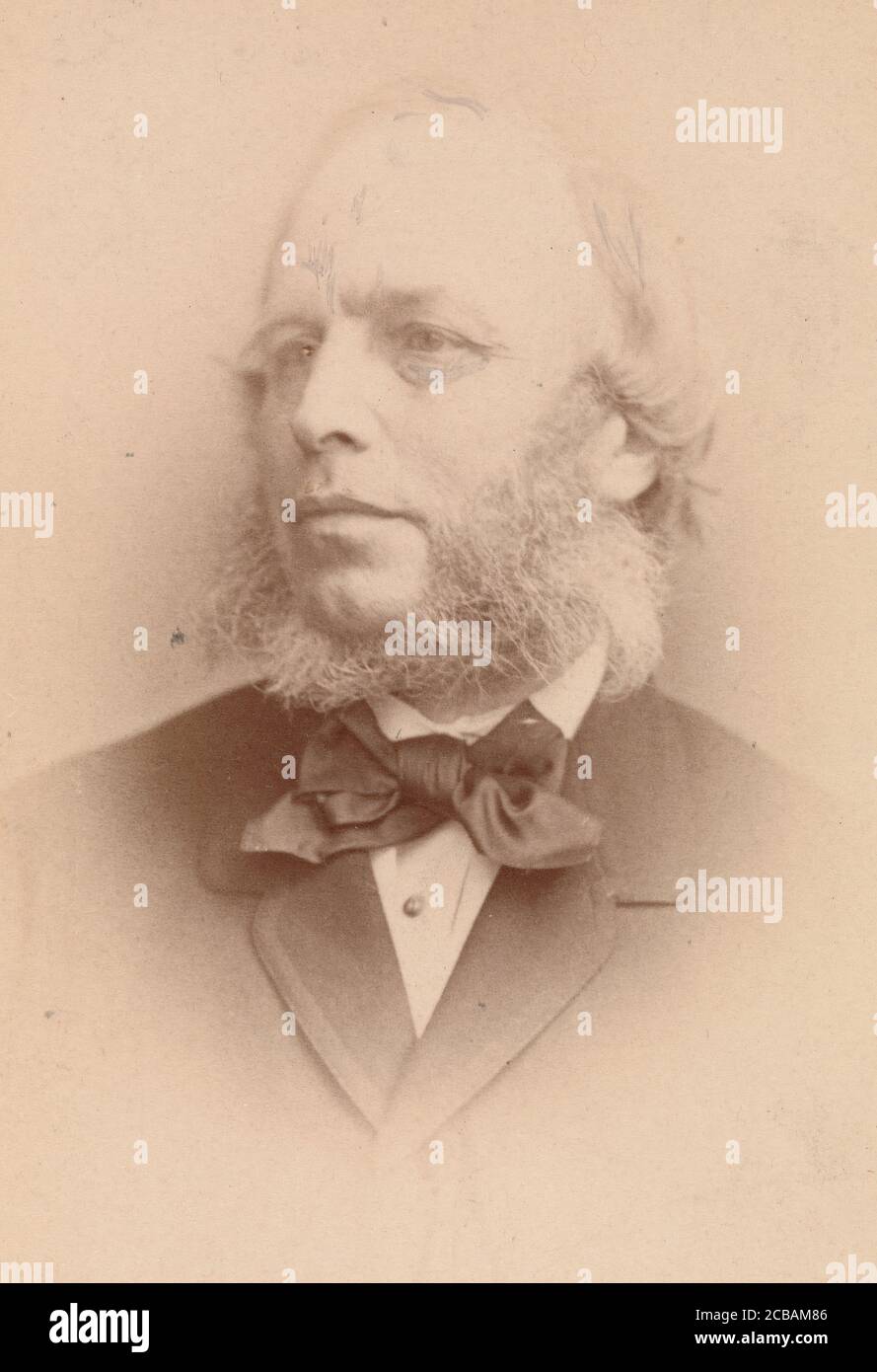 Stocks lumb hi-res stock photography and images - Alamy