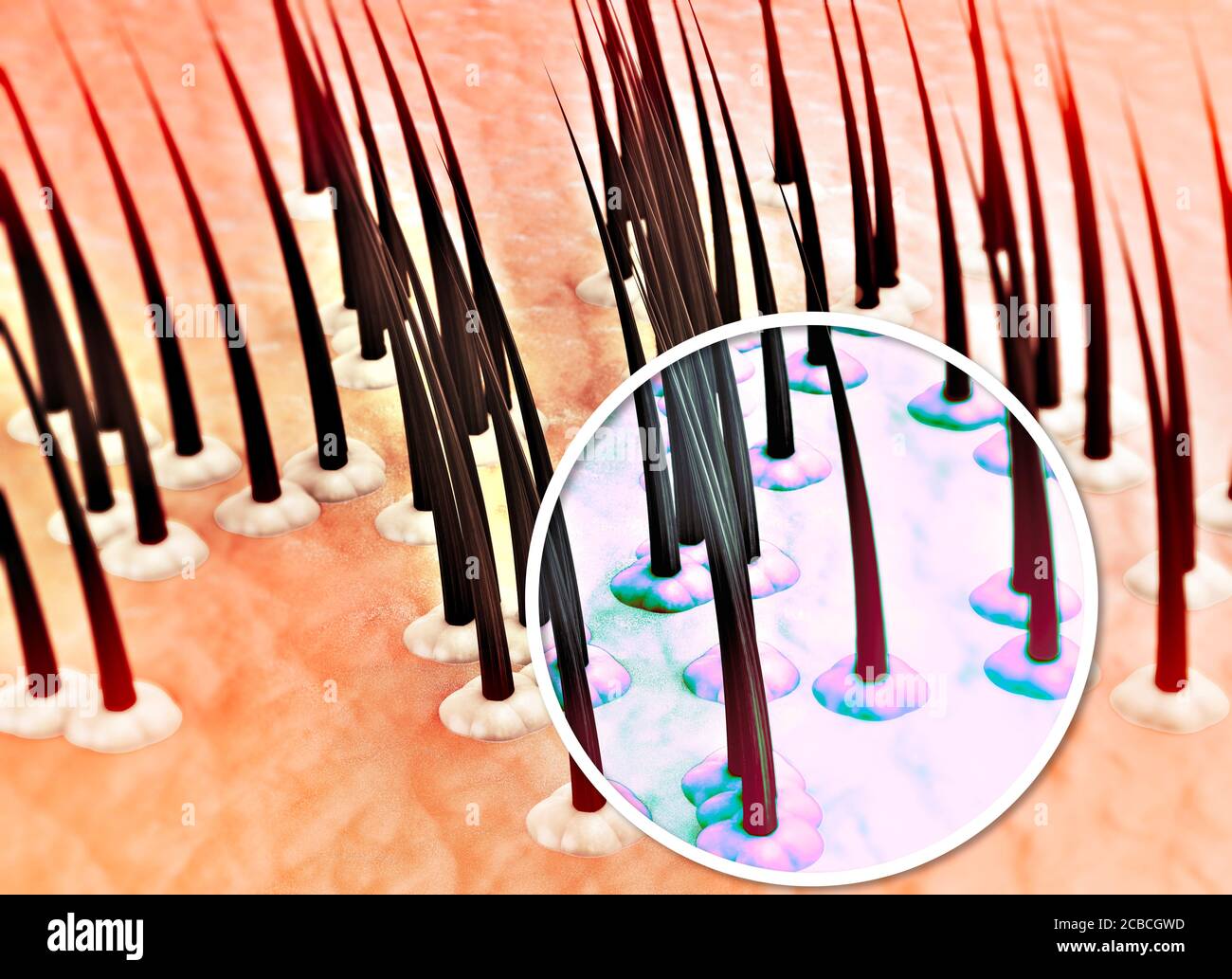 Surface of the skin, hair, hair health, trichology, fat, dandruff of ...