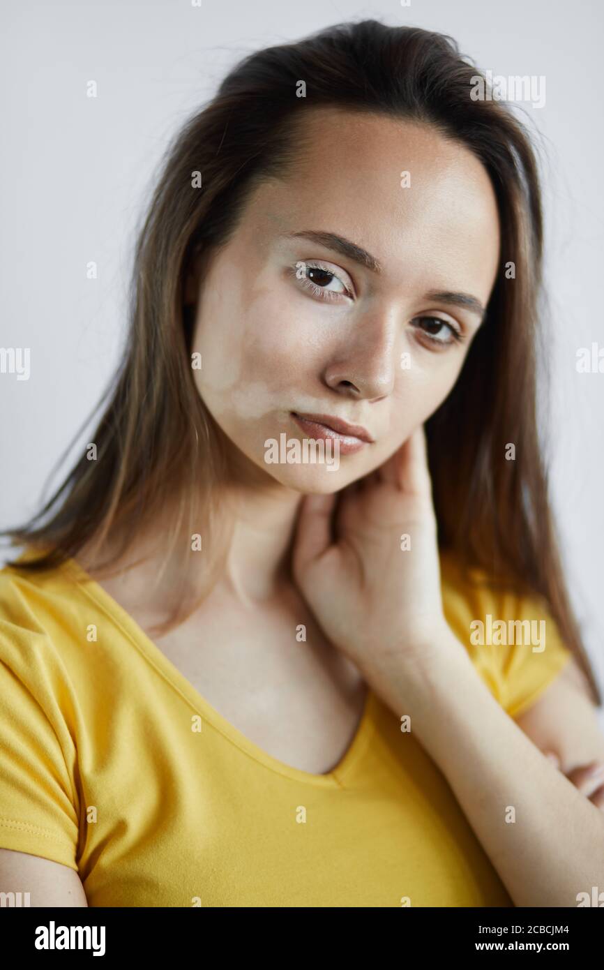 Skin desease hi-res stock photography and images - Alamy Skin desease hi-res stock photography and images - Alamy