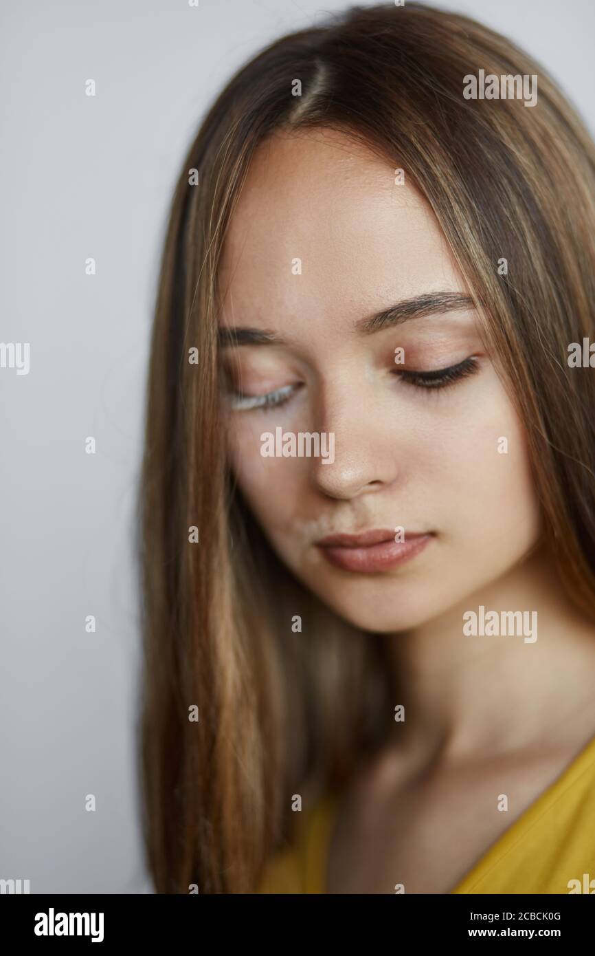 woman eats bad unhealthy food. girl with a spot on her face looking ...