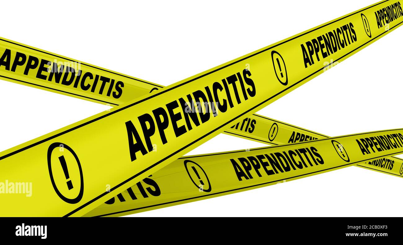 Yellow warning tapes with black words APPENDICITIS (a medical condition ...
