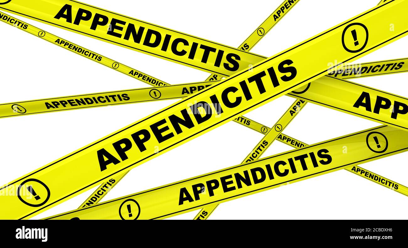 Yellow warning tapes with black words APPENDICITIS (a medical condition ...