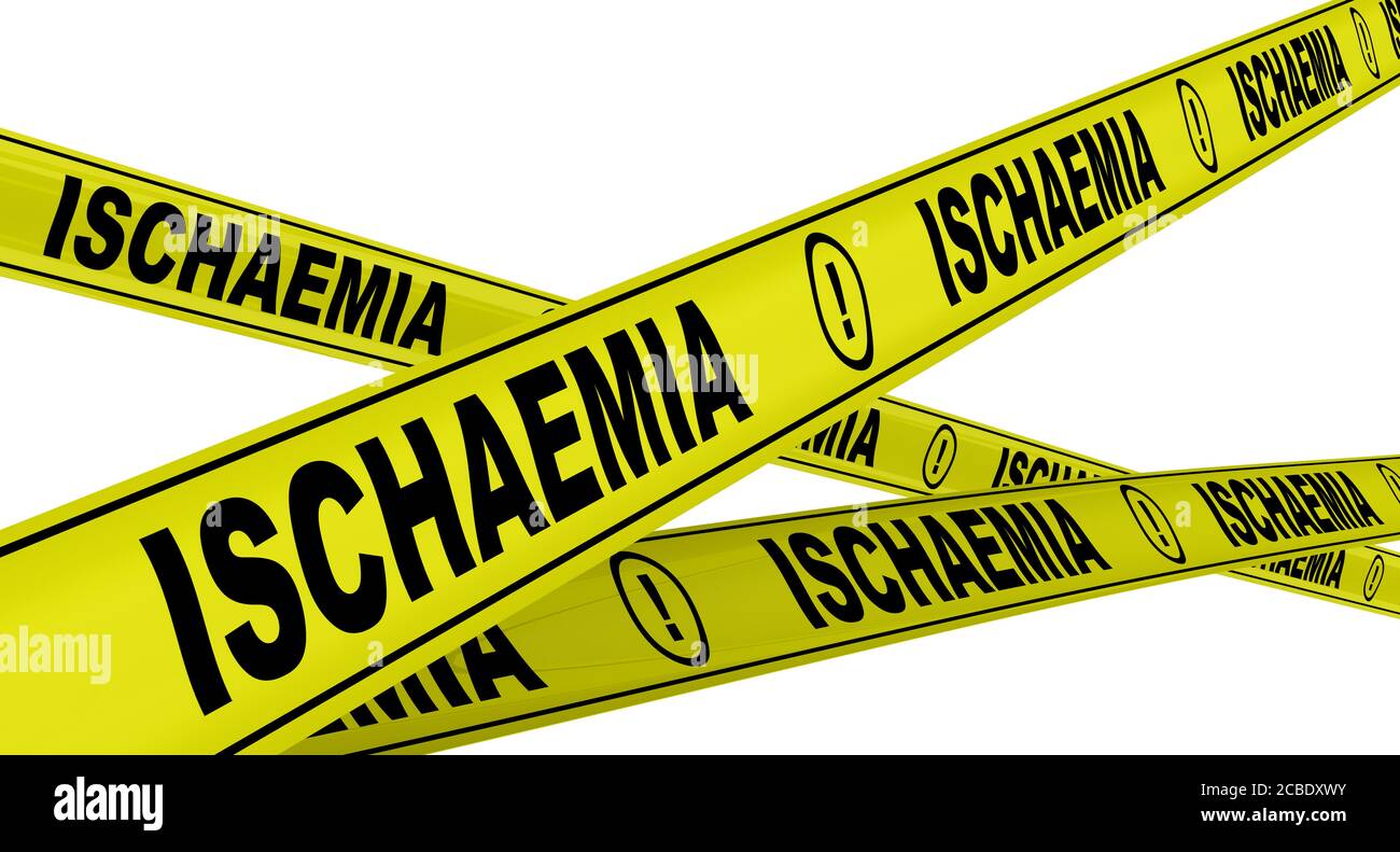 Ischaemia. Yellow warning tapes with black words ISCHAEMIA (is a ...