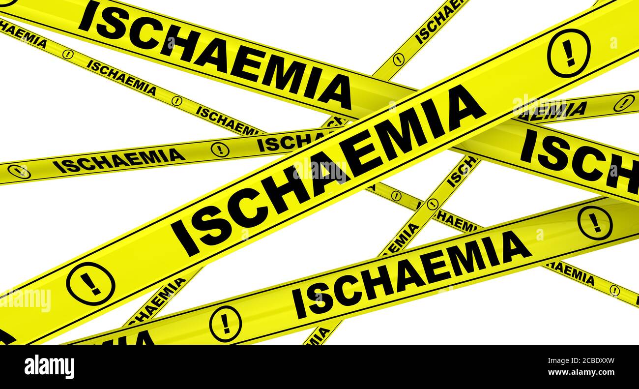Ischaemia. Yellow warning tapes with black words ISCHAEMIA (is a ...