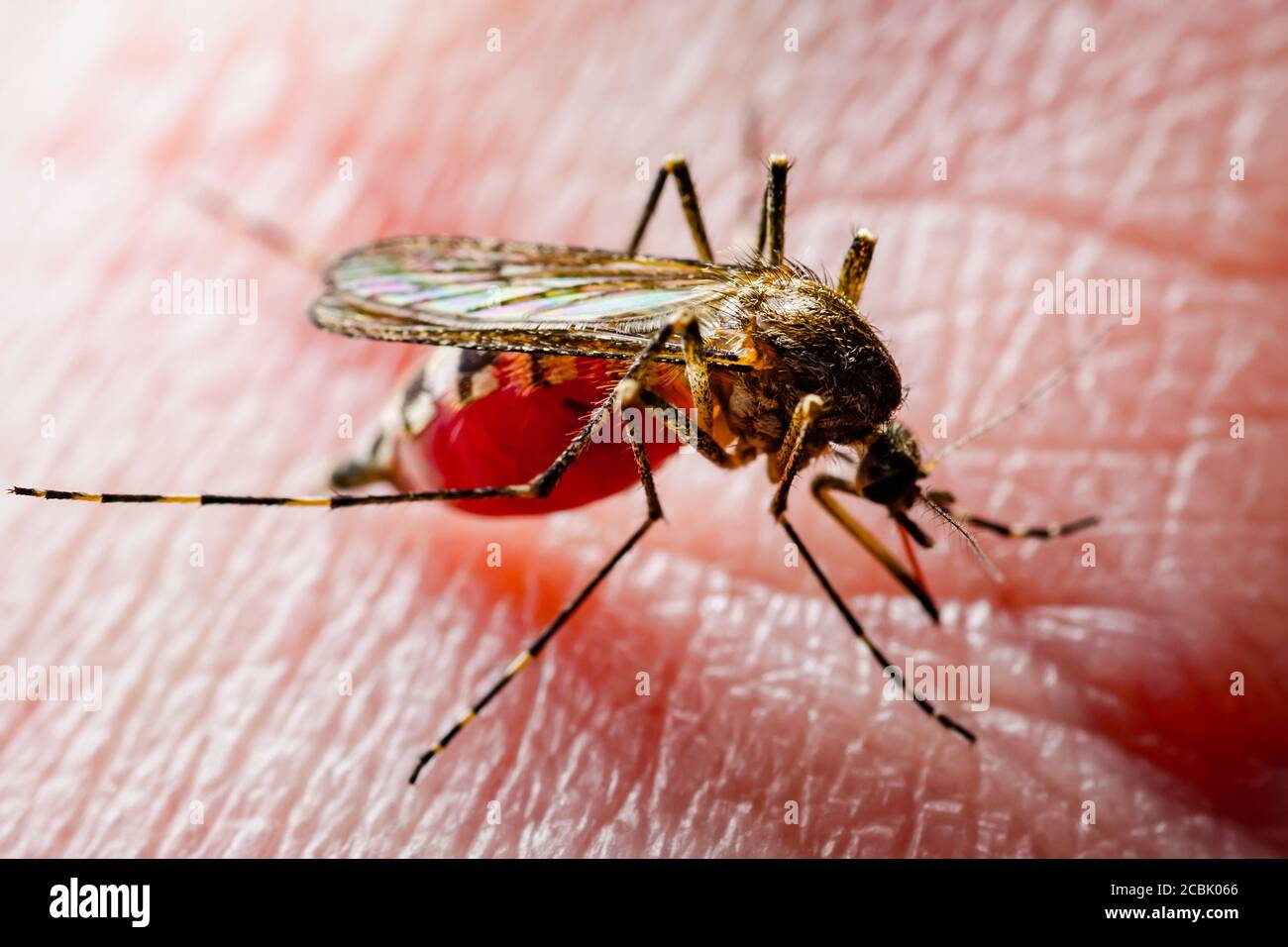 Dangerous Culex Mosquito Bite, Leishmaniasis, Encephalitis, Yellow ...