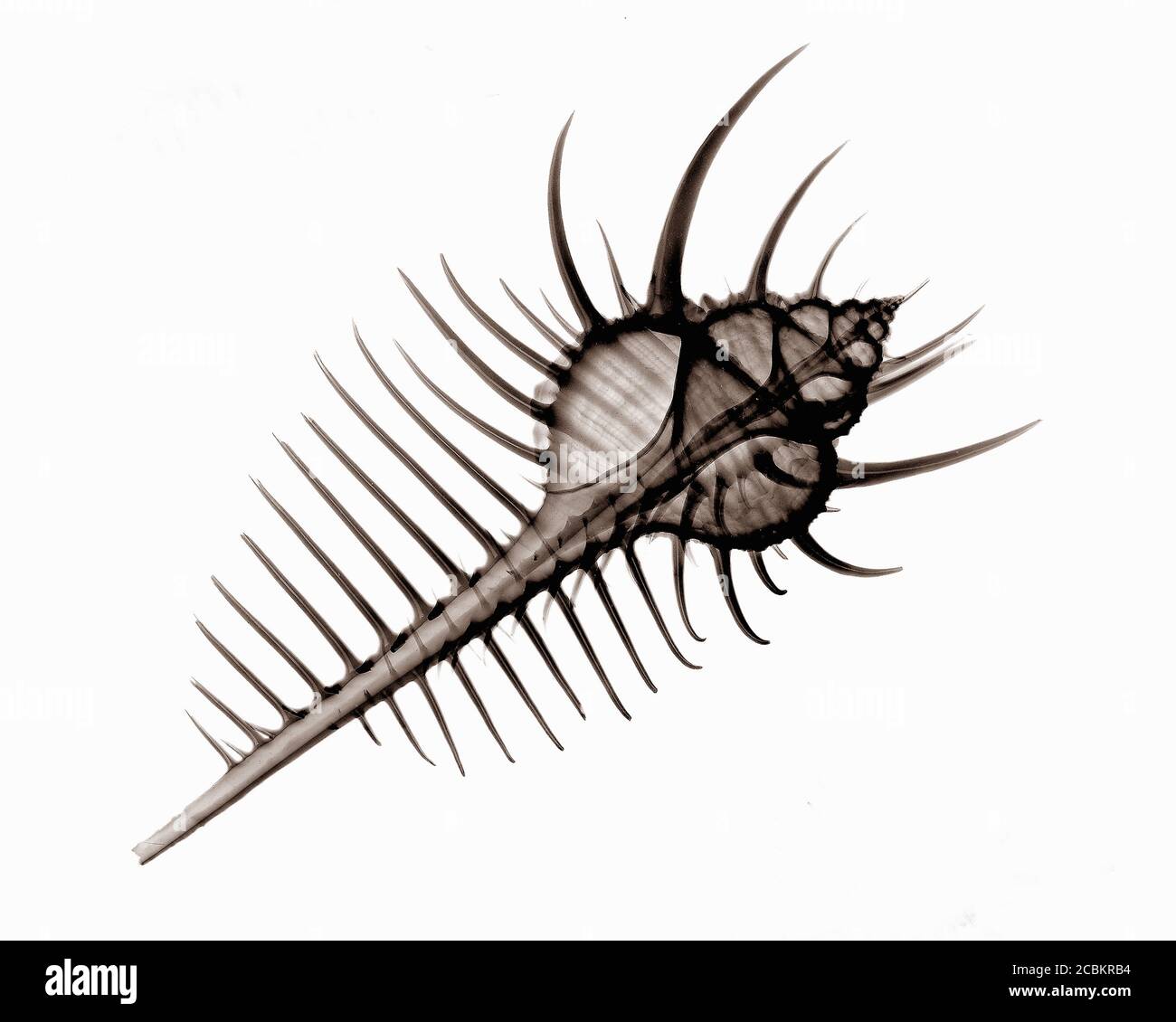 Venus x ray image Cut Out Stock Images & Pictures - Alamy