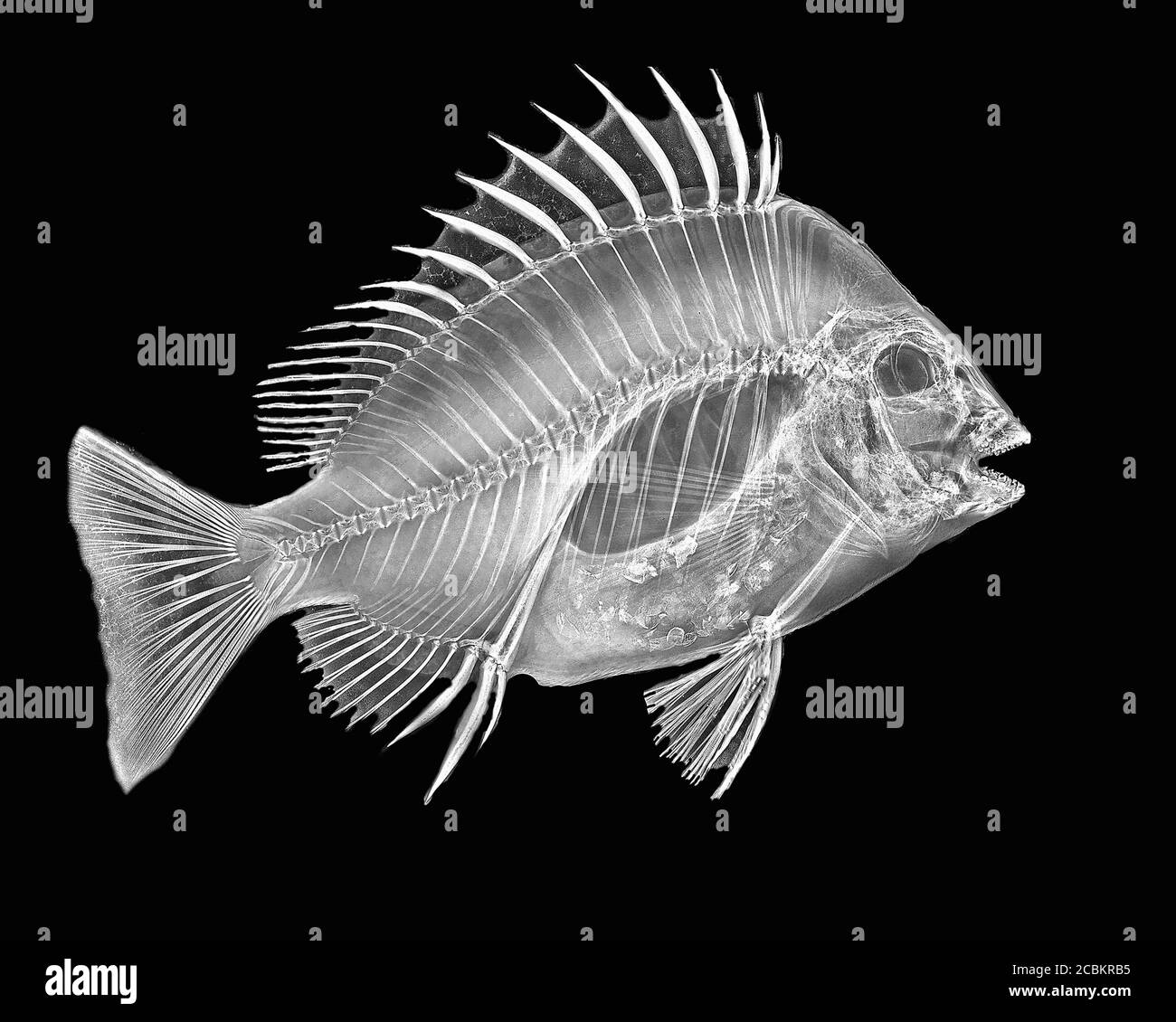 X ray fish hi-res stock photography and images - Alamy