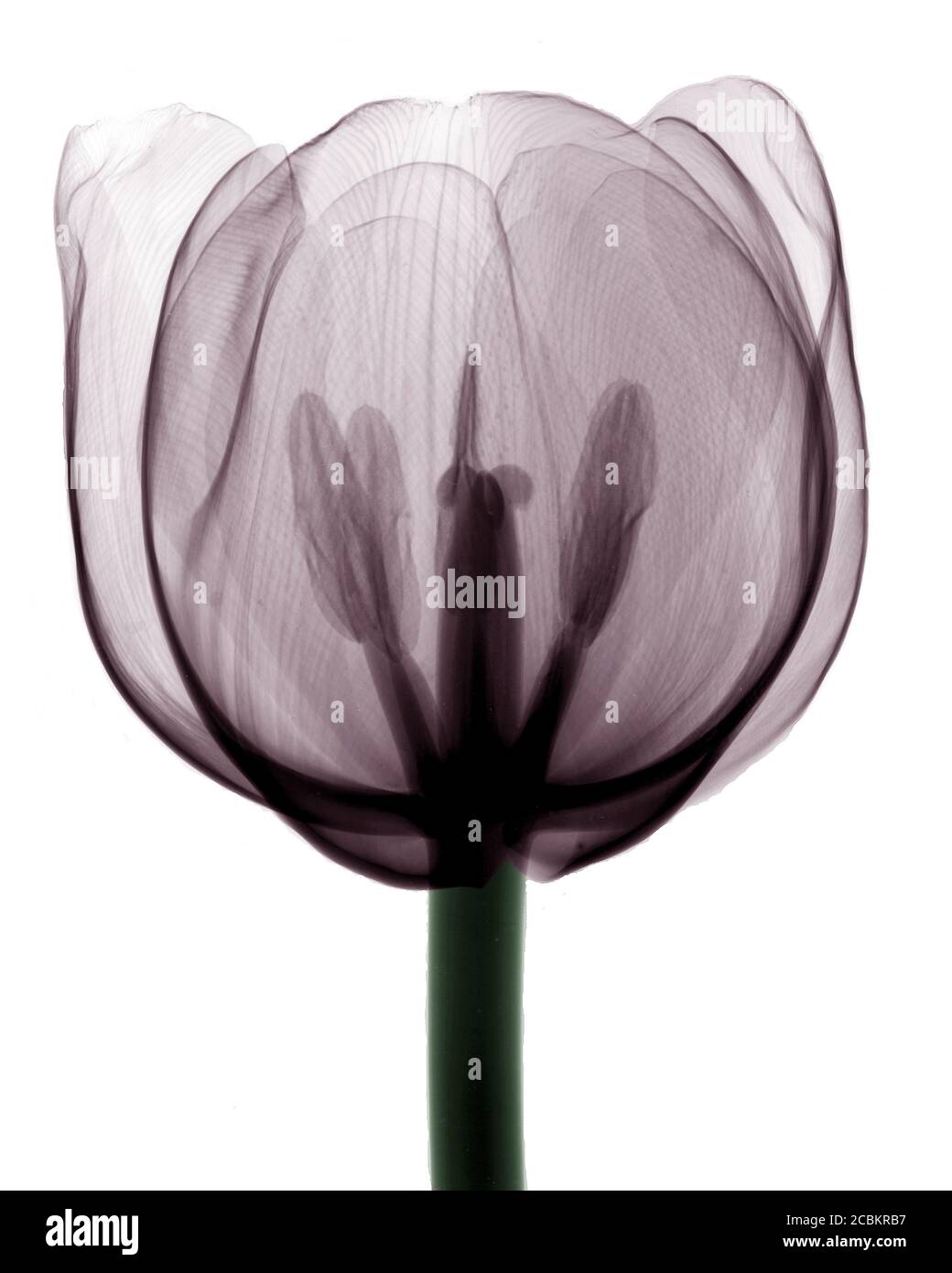 X-ray image of tulip flower Stock Photo - Alamy