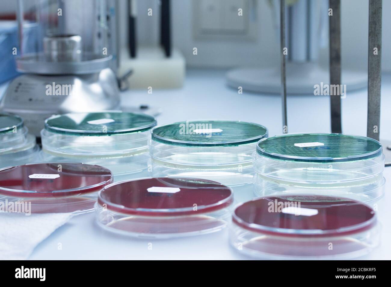 Growing Bacteria In Petri Dishes Lab Report at Maddison Helms blog