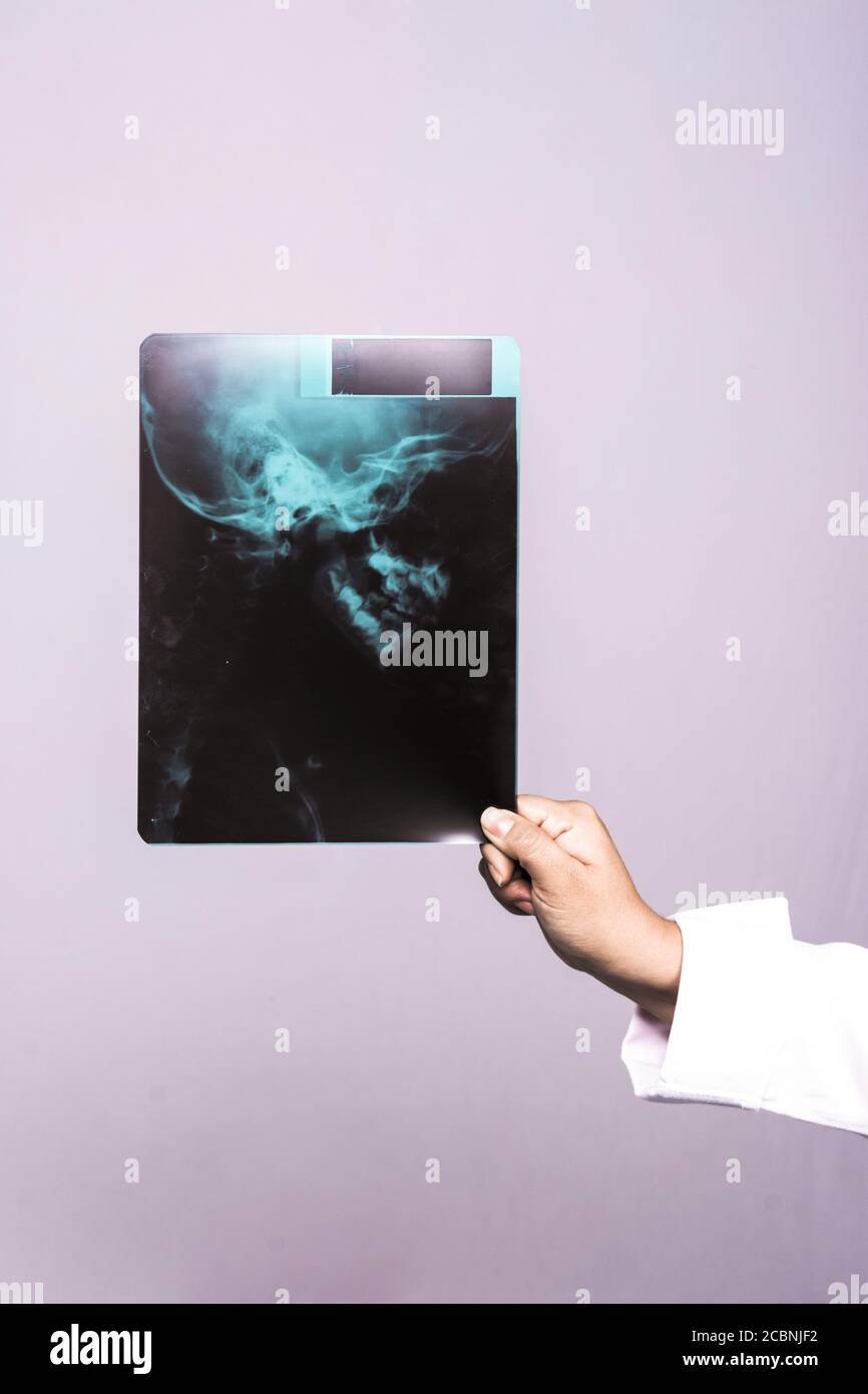 Close up of a male doctor holding X-Ray Radiography on a purple ...
