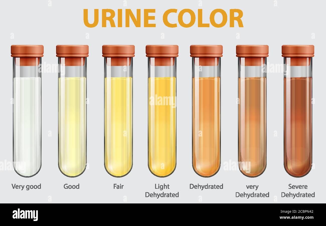 Illustration of urine color chart illustration Stock Vector Image & Art ...