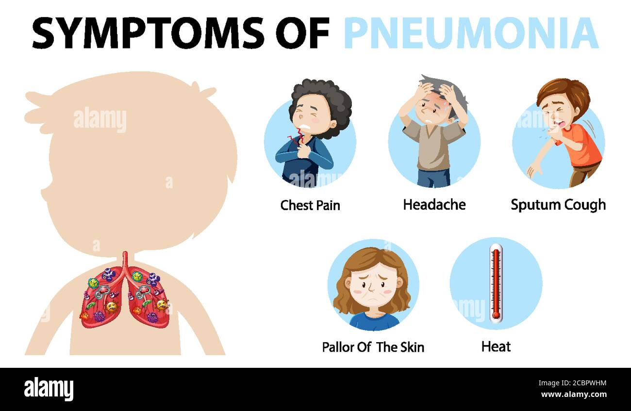 Symptoms of pneumonia cartoon style infographic illustration Stock ...