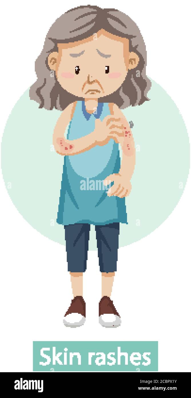 Cartoon character with skin rashes symptoms illustration Stock Vector ...