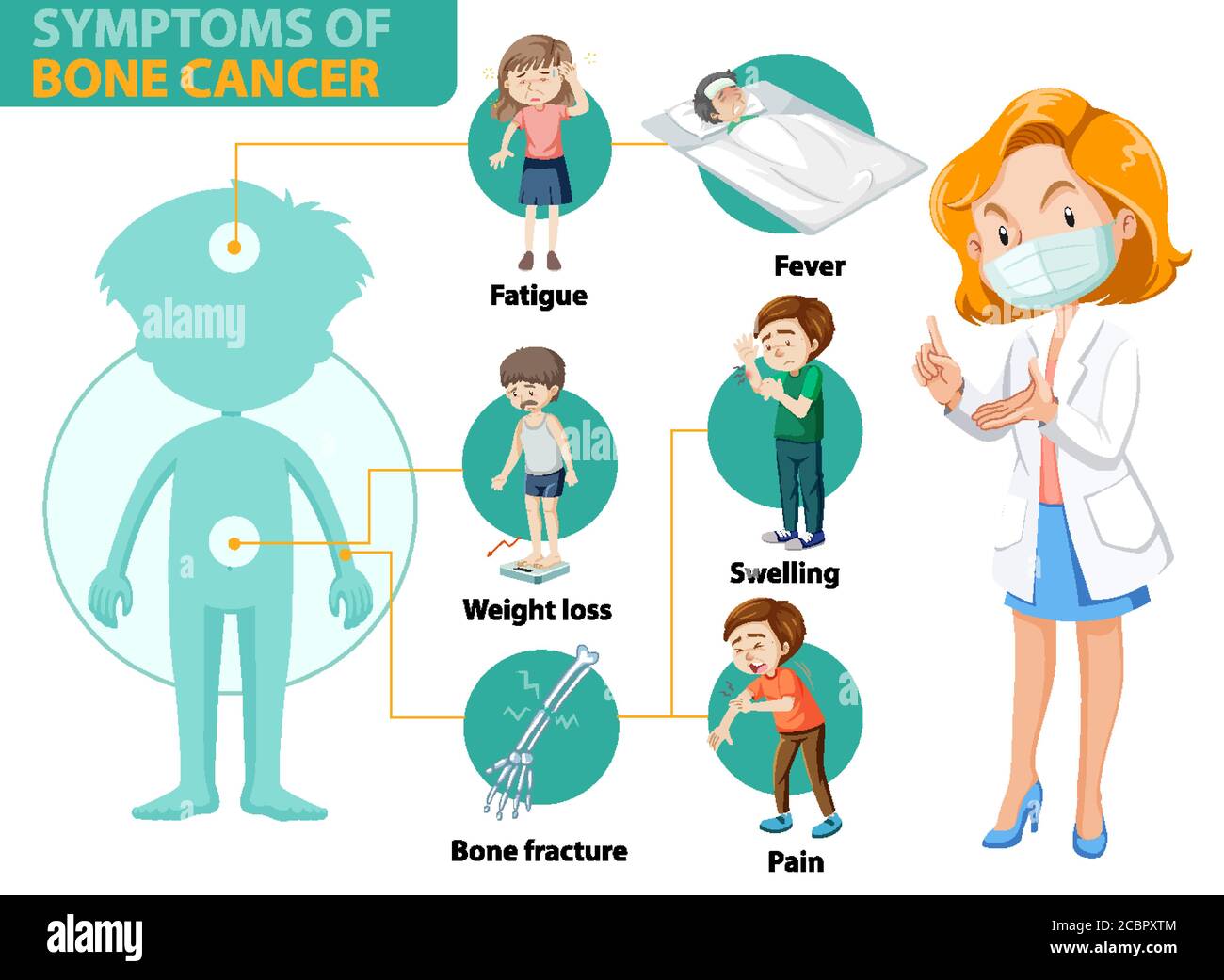 Medical infographic of bone cancer symptoms illustration Stock Vector ...