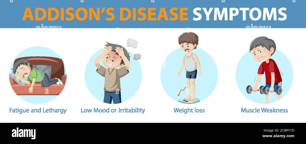 Medical infographic of Addison's disease symptoms illustration Stock ...