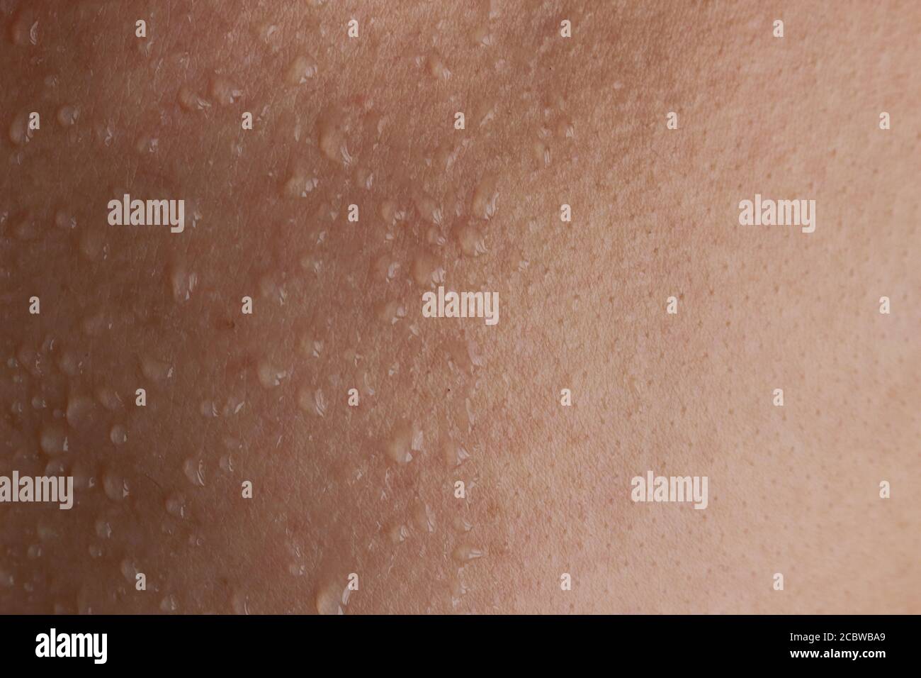 Skin sport hi-res stock photography and images - Alamy
