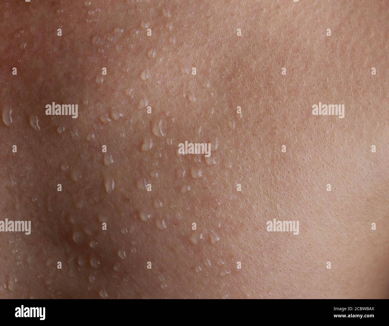 Skin closeup sweating hi-res stock photography and images - Alamy