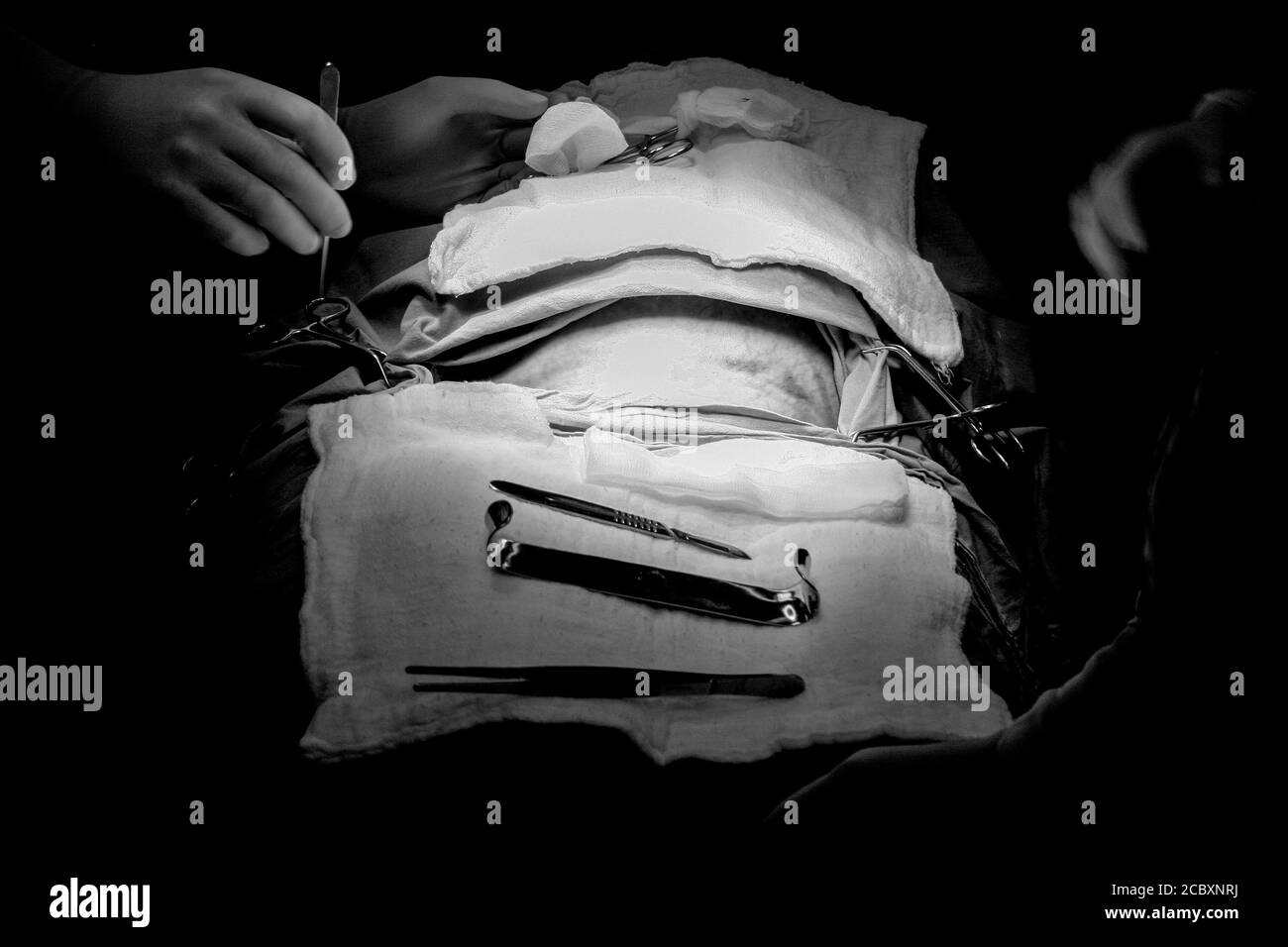 hospital operation preparation and equipment in Turkey Stock Photo - Alamy