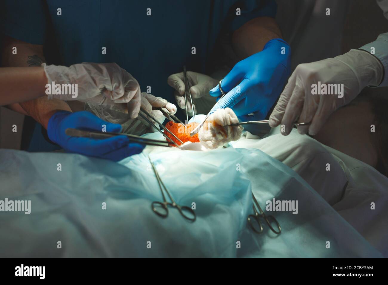 Peritoneal High Resolution Stock Photography and Images - Alamy