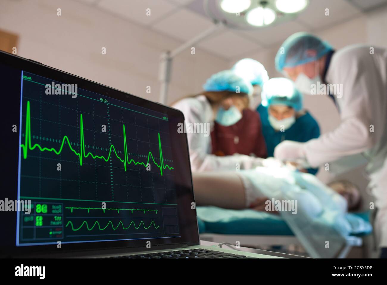 Monitoring of ECG and saturation O2 in the patient in the operating ...