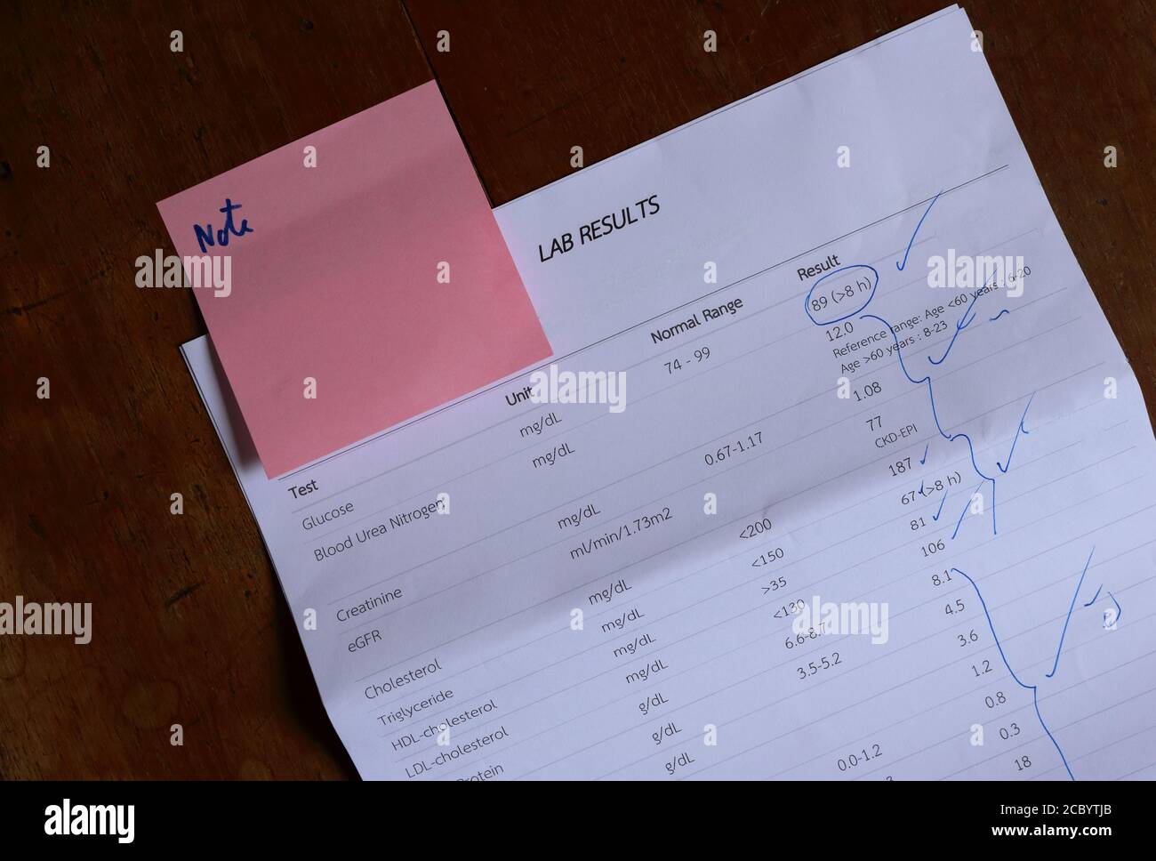 Egfr test hi-res stock photography and images - Alamy