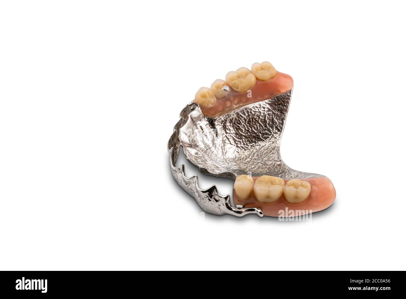 Removable swinglock type denture isolated on white background with ...