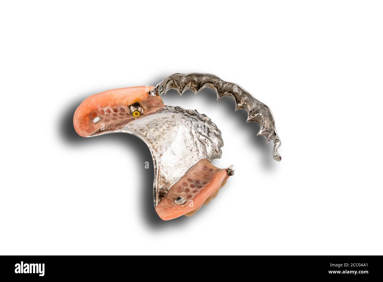 Removable partial metal swinglock upper denture opened on white ...