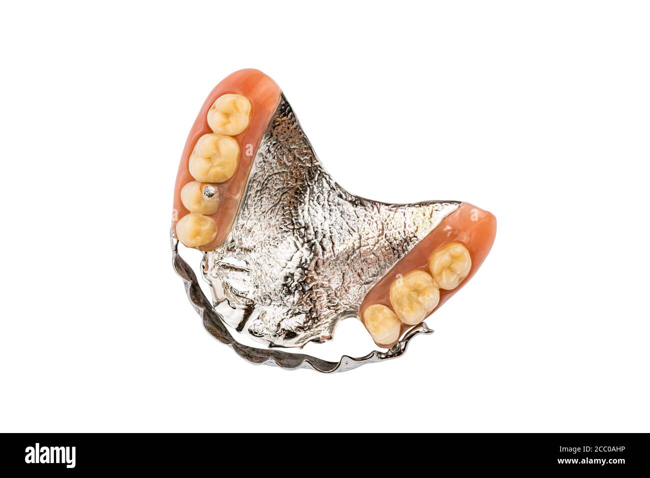 Top view of partial metal removable swinglock denture on white ...