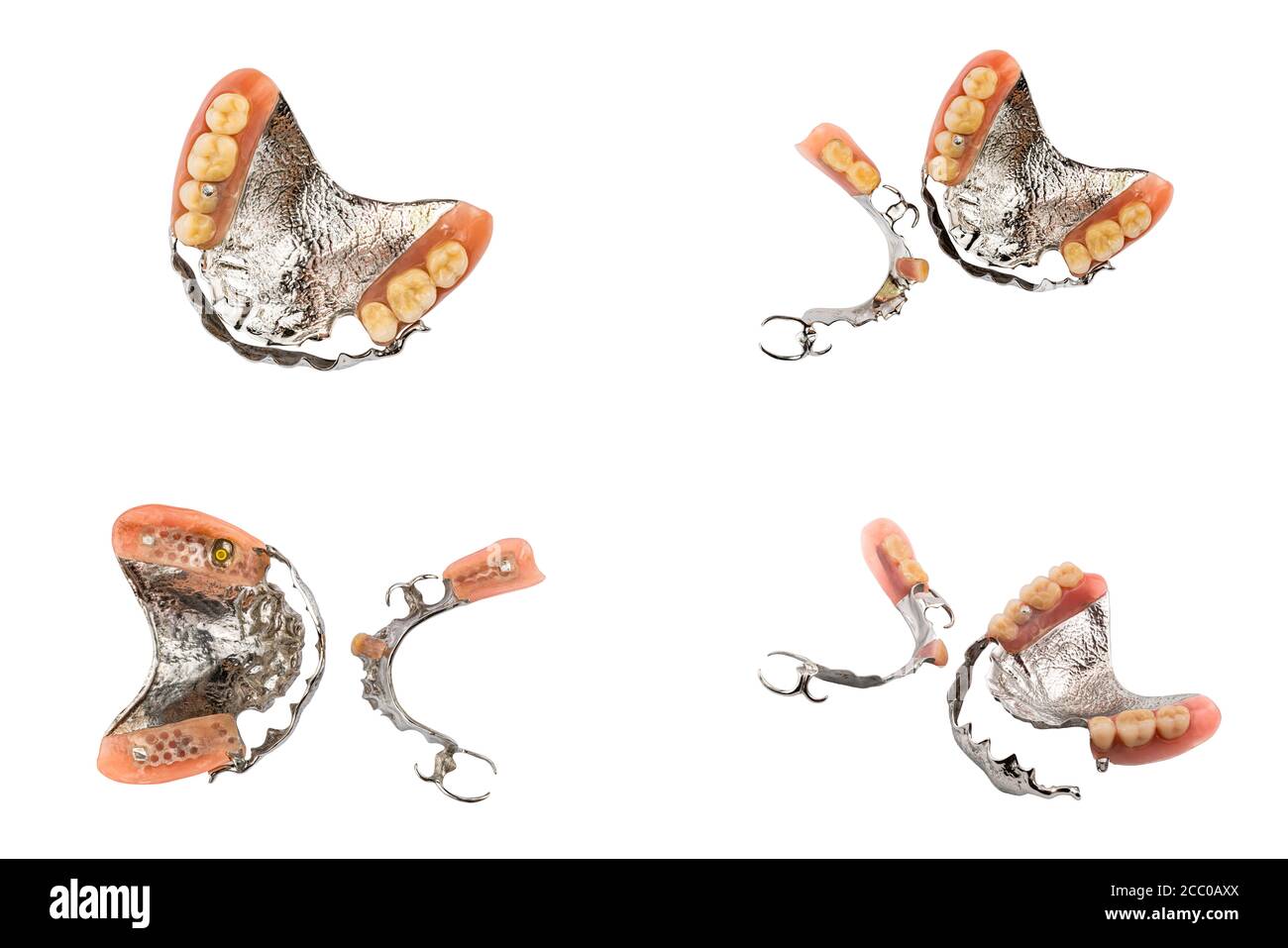 Upper and lower partial metal removable dentures set on white ...