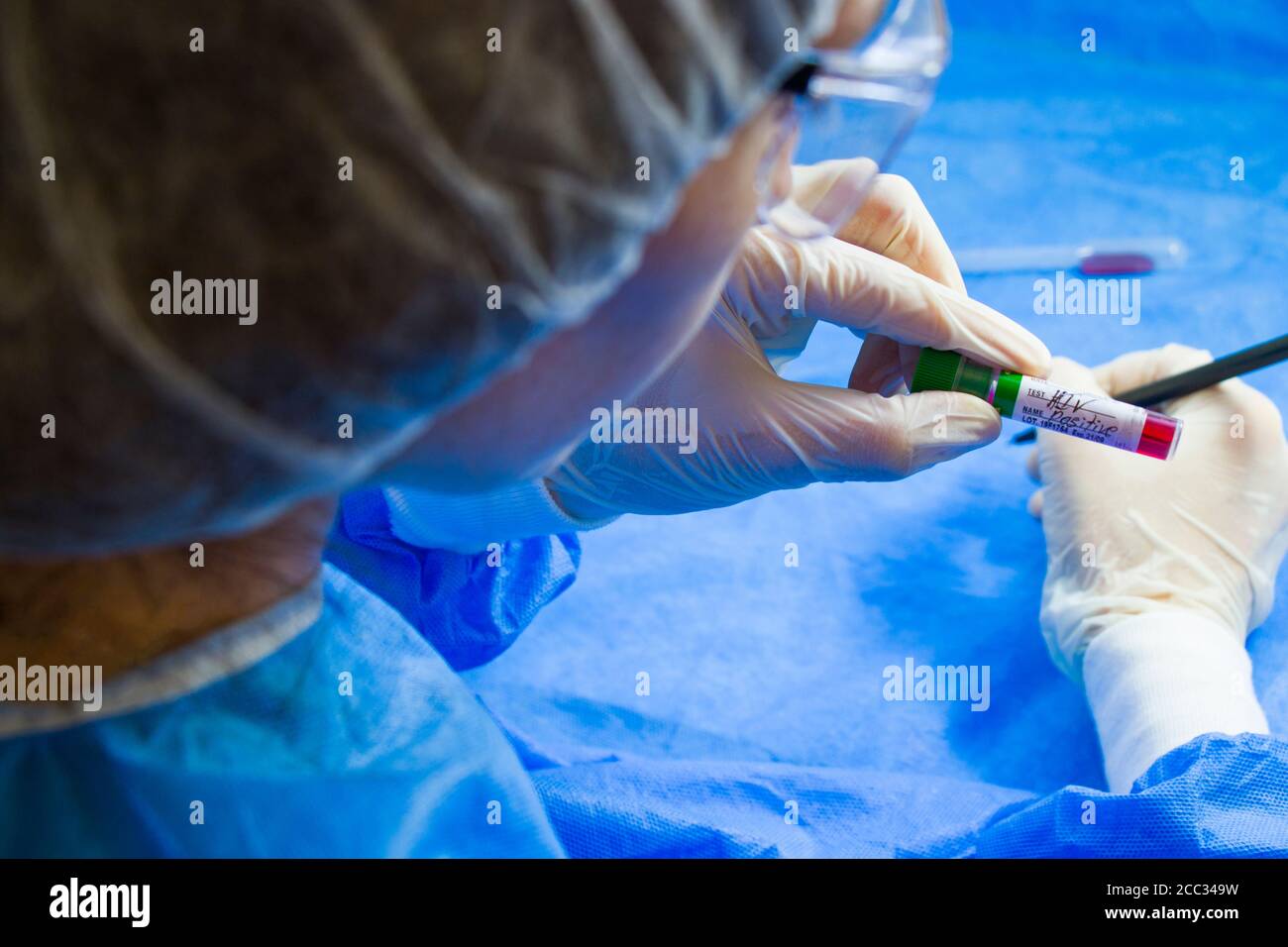 Hiv and aids infection test, doctors face and hand holding tube with ...
