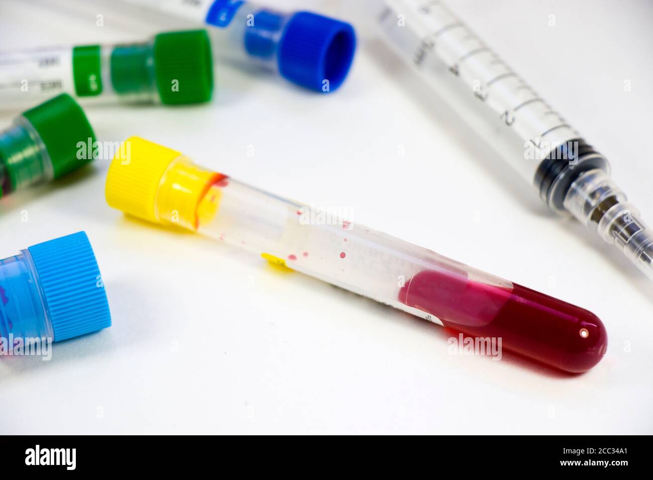 Chemical laboratory instruments, glassware and pipette. Tests and ...