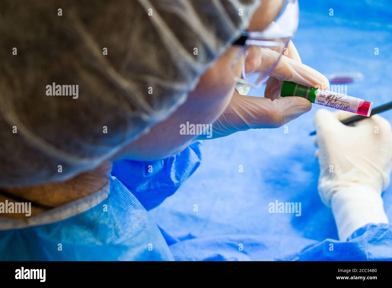 Hiv and aids infection test, doctors face and hand holding tube with ...