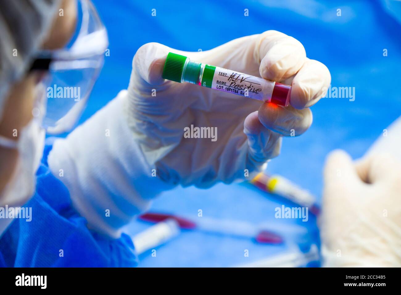 Hiv and aids infection test, doctors face and hand holding tube with ...