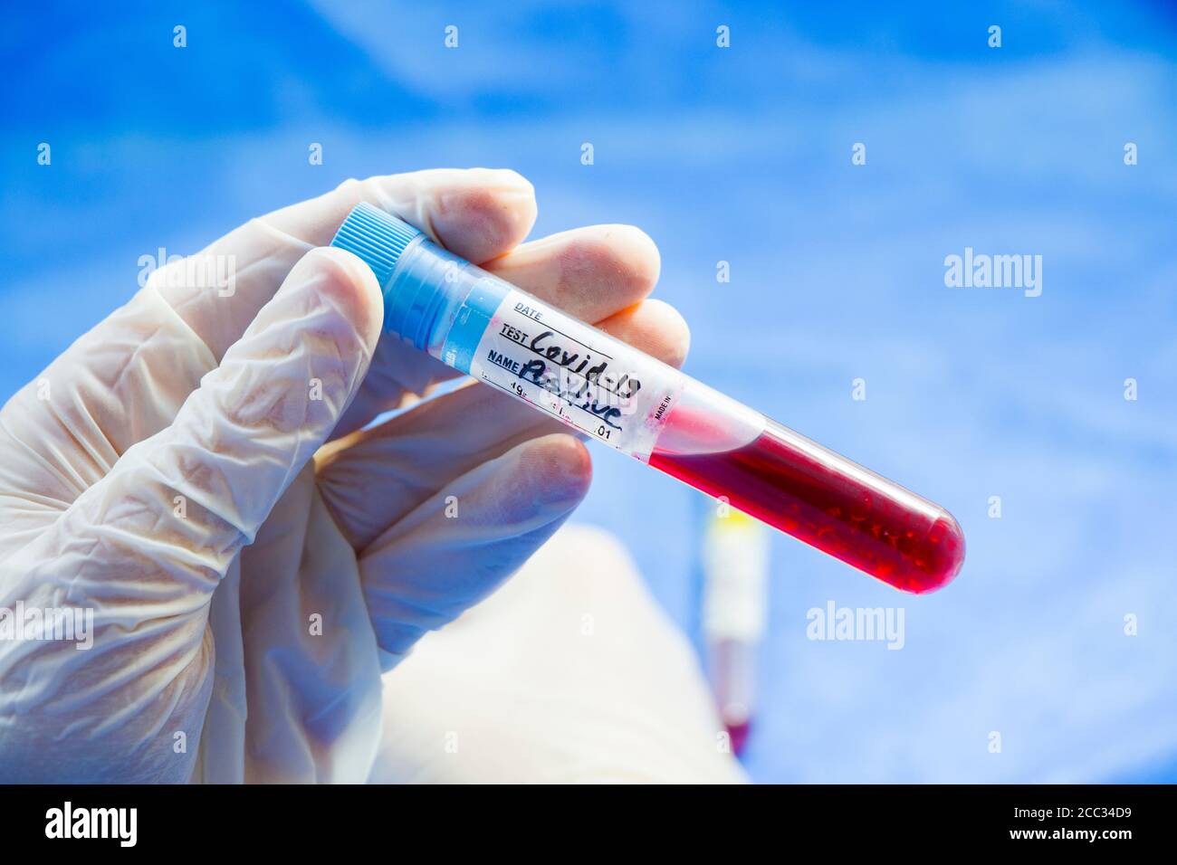 Covid - 19 and corona virus blood test sample, negative and positive ...
