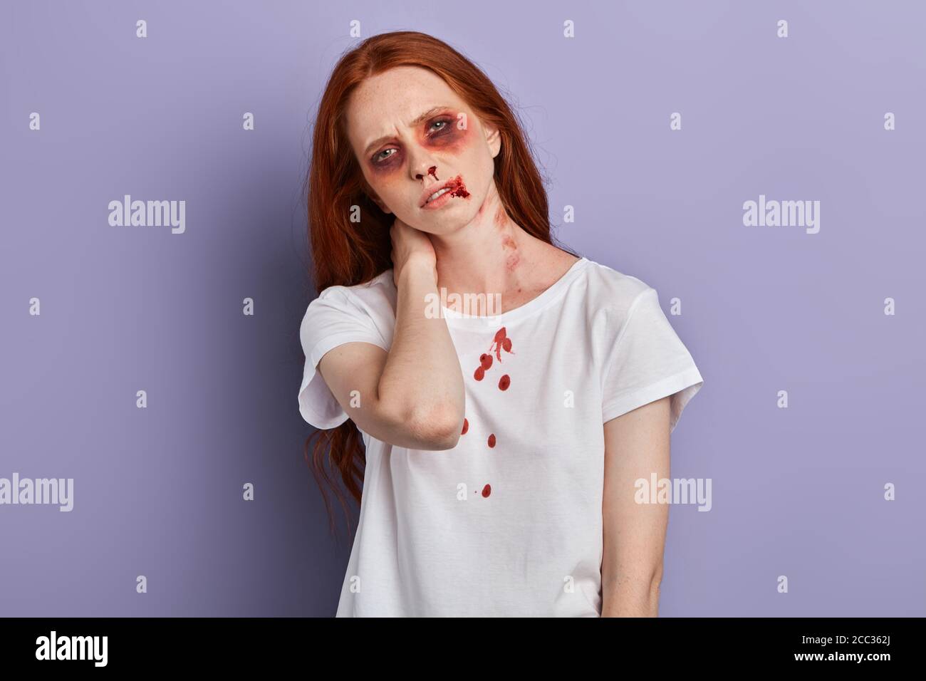 portrait of a red-haired young girl with scratches and bruises on hes ...