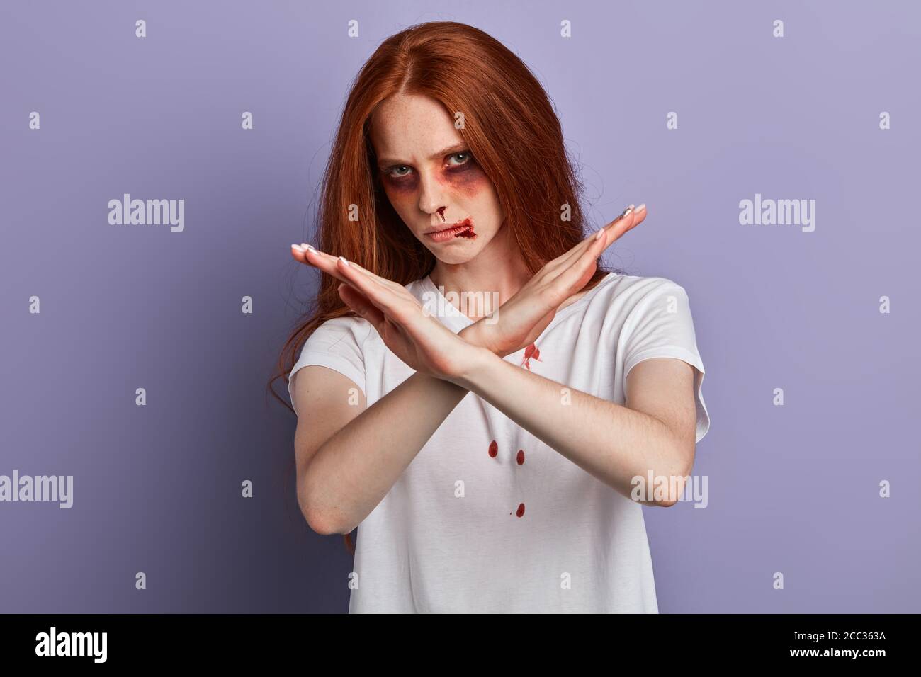 weak injured girl with crossed arms posing to the camera. isolated blue ...
