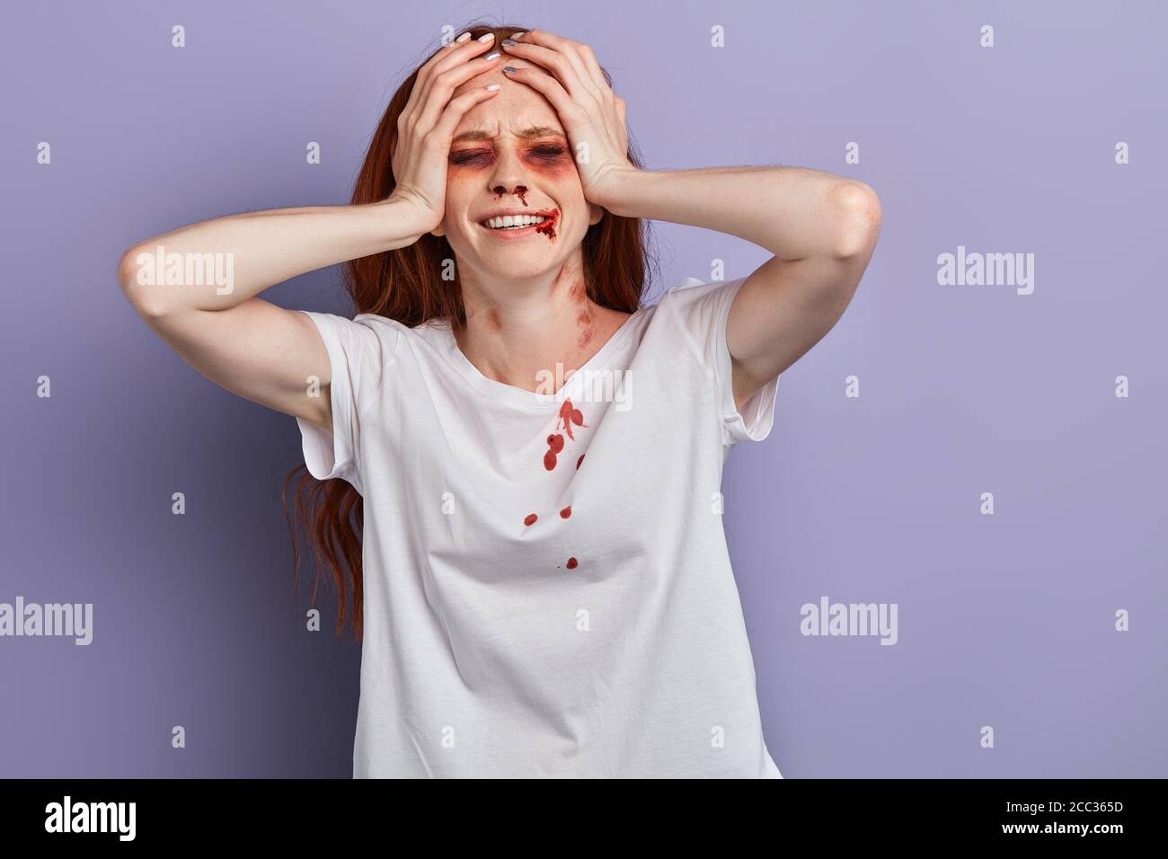 crying woman with bruised skin and black eyes touching her head ...